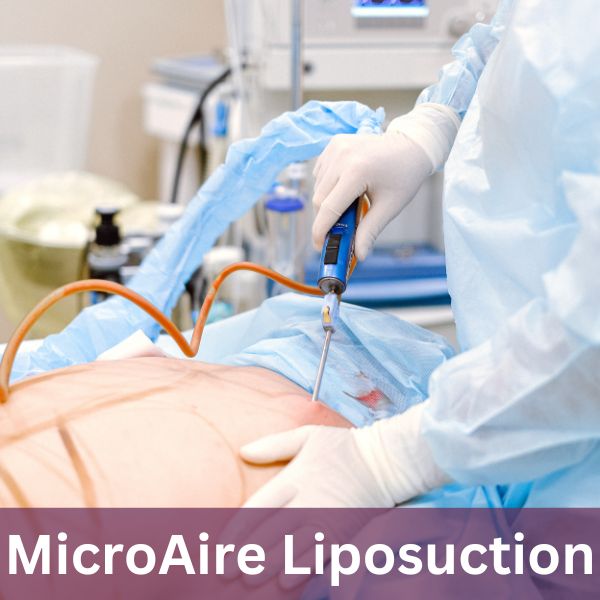 MicroAire Liposuction for Body Contouring and Fat Removal